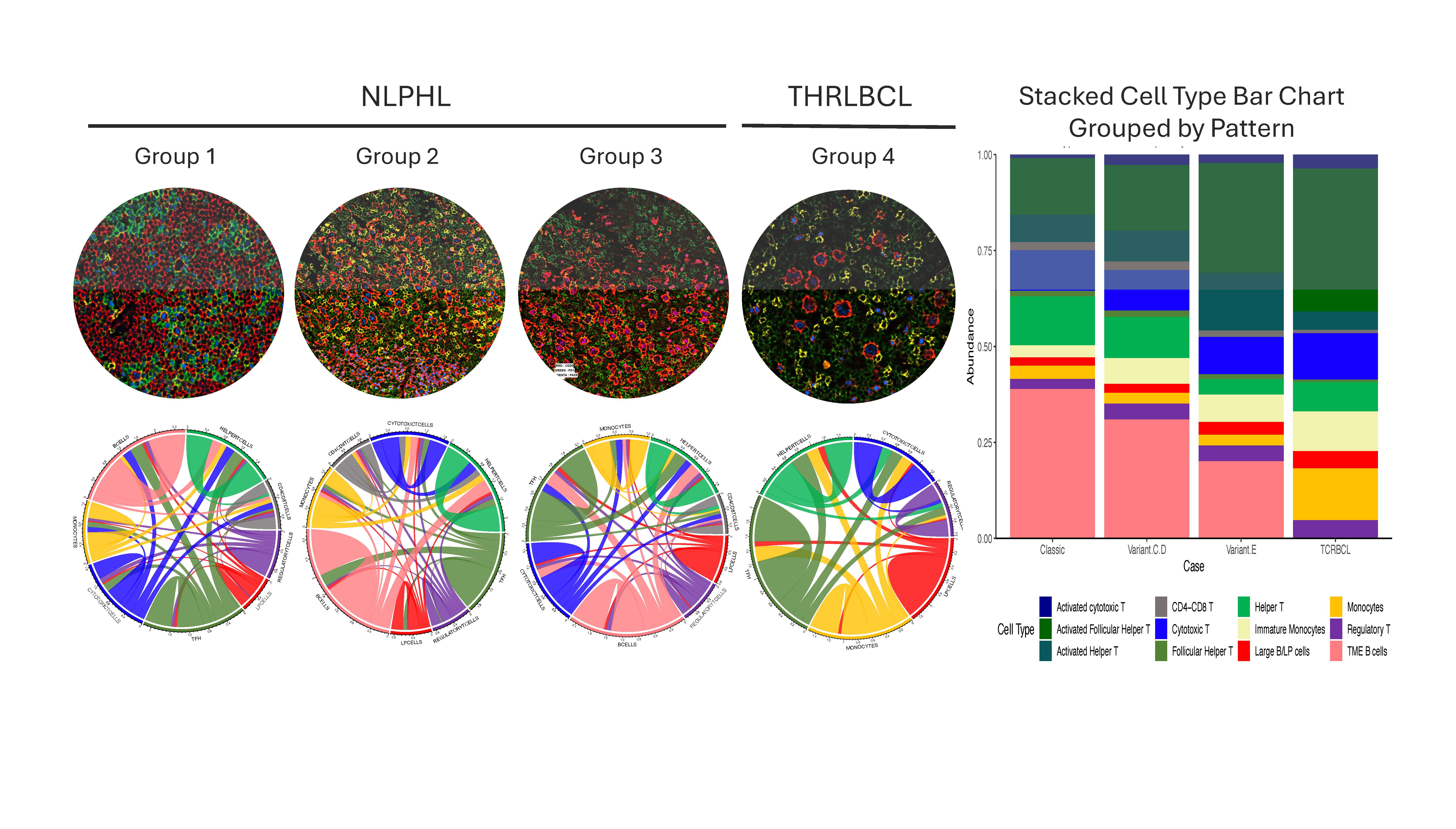 Spatial Proteomics Offer Novel Insights into Rare Lymphomas with Sparse Tumor B-Cells | Research ...